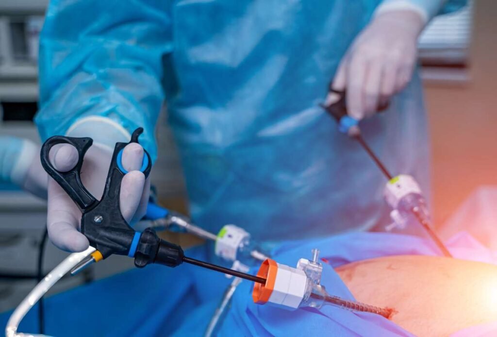 Cirugía de Vesícula: Beneficios y Cuidados Postoperatorios – Dr ...