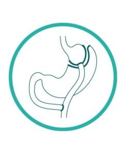 Baipás Gástrico: la cirugía para una pérdida de peso efectiva – Dr ...